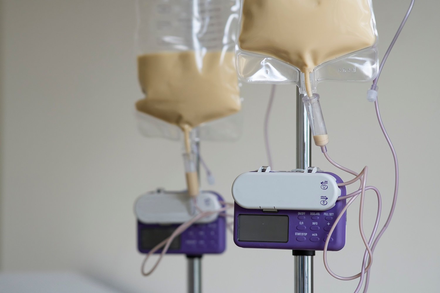 Nutrition management of acutely unwell patients in acute medical units